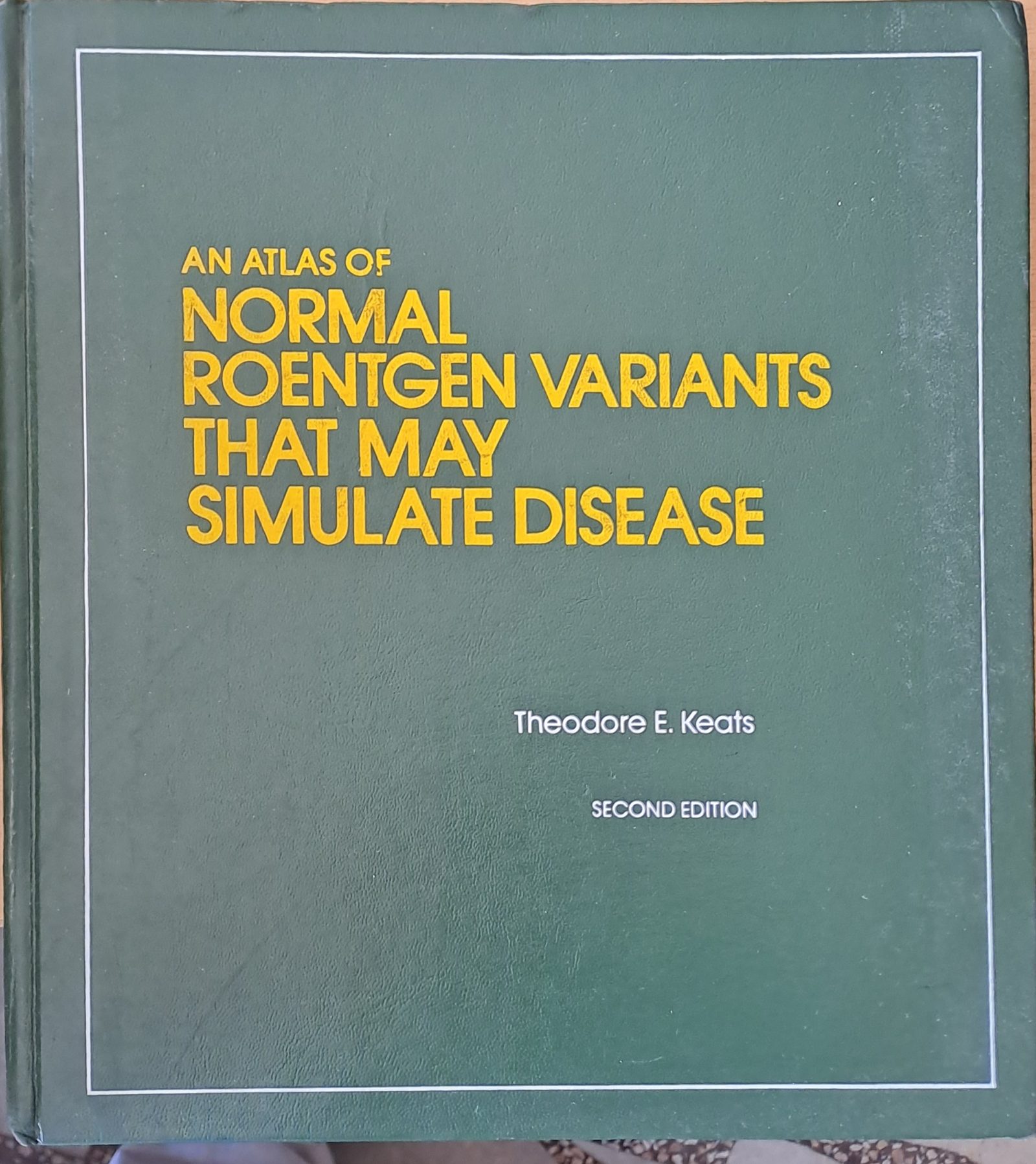 An Atlas of Normal Roentgen Variants that may simulate Disease, second ...